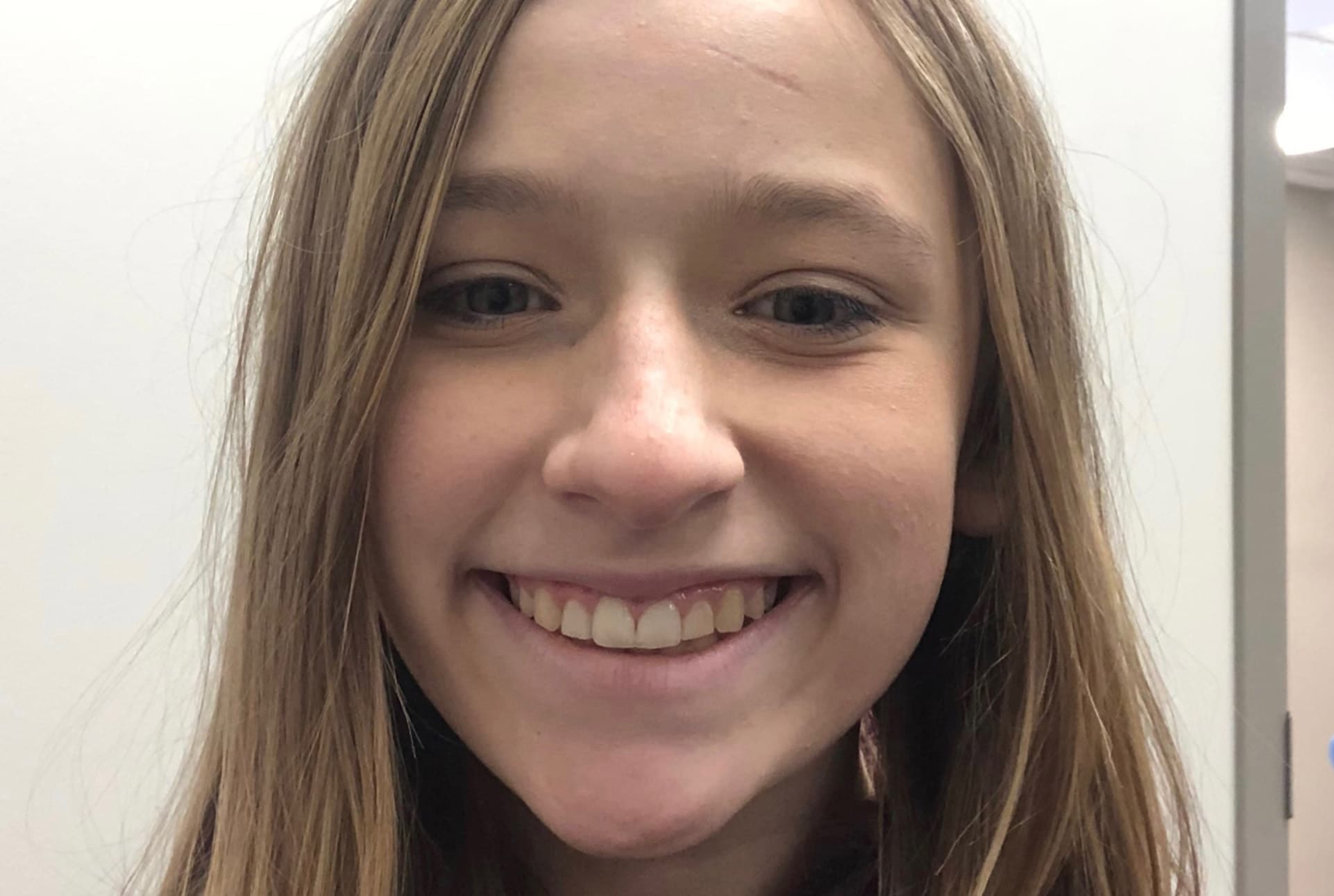 Virtual Smile Assessment - Rose Orthodontics